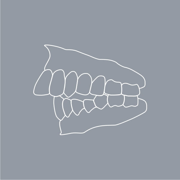 矯正歯科｜ココ歯科｜広島市安佐南区の歯医者。矯正・ホワイトニングなど